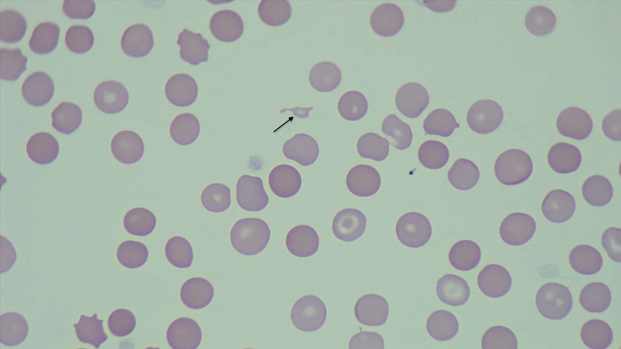 Alterações da membrana/ metabólicas – Atlas de hematologia veterinária