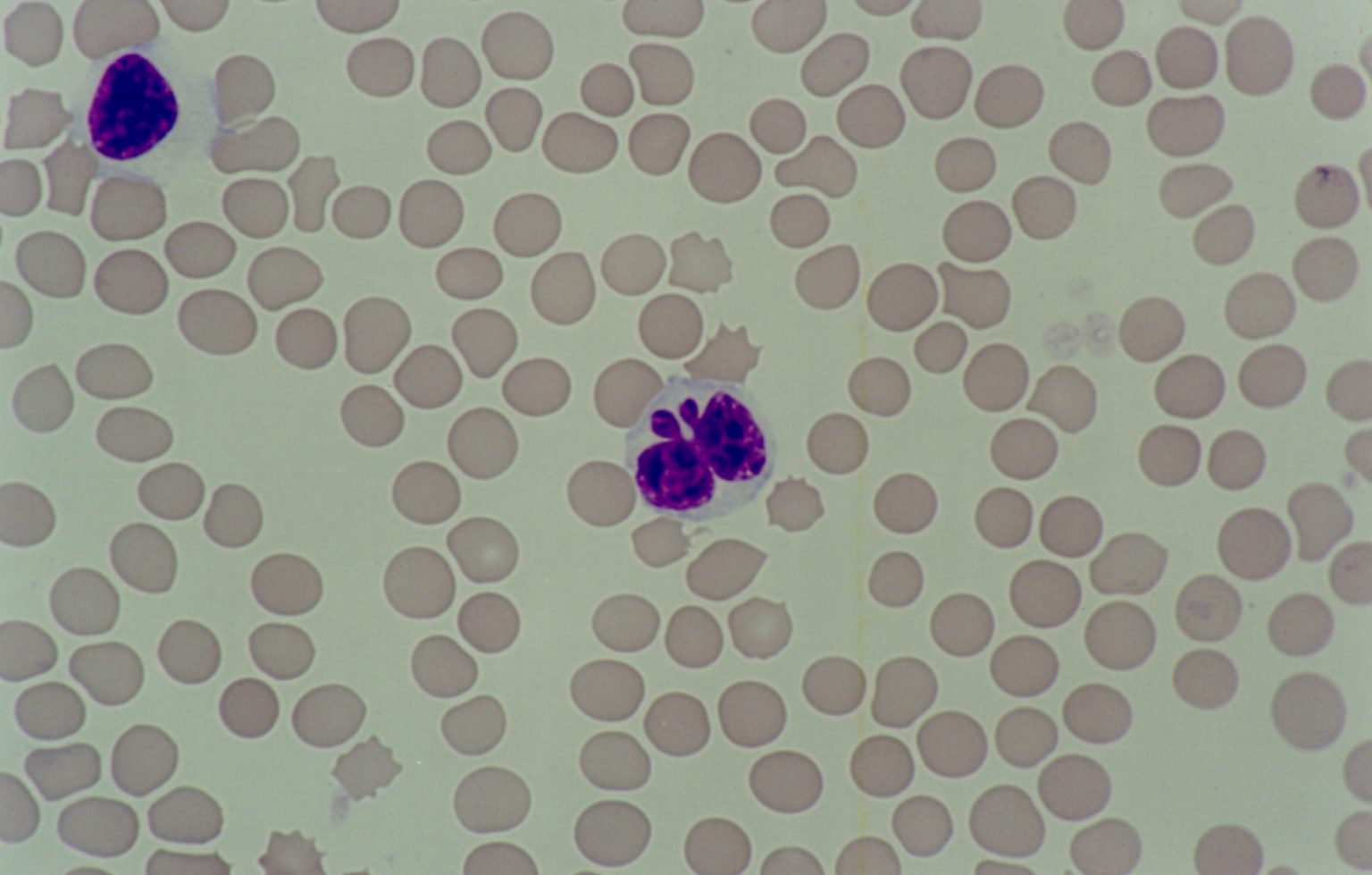 Monócitos – Atlas de hematologia veterinária